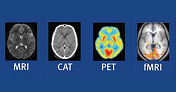 Studying Brain Imaging Technology to Use After Traumatic Injury