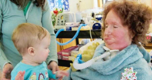 I’m Beating the Odds, Living a Long Life with ALS